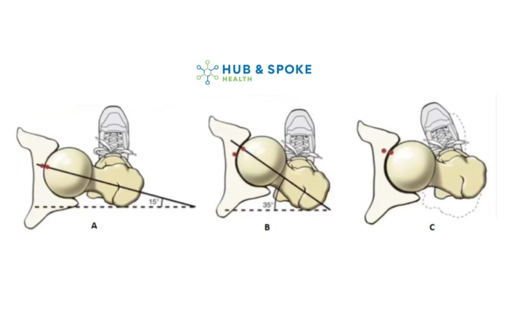 Understanding W-Sitting In Kids: What’s Normal And When To Be Concerned ...